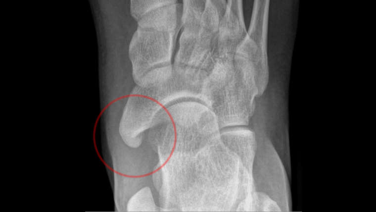 Dzieci – Poradnia Stopy